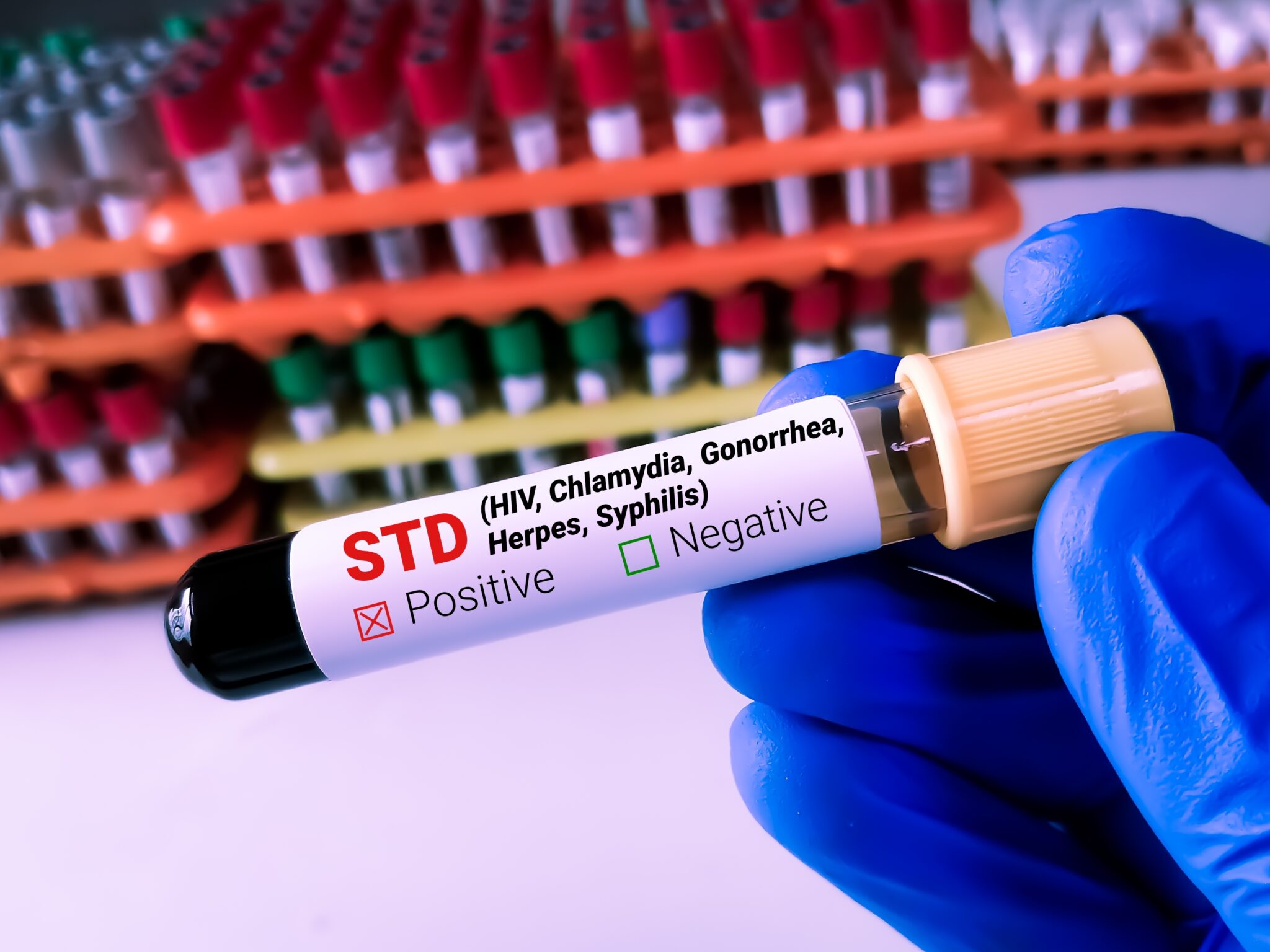 HIV and STI/STD Prevention Program | Alianza of New Mexico